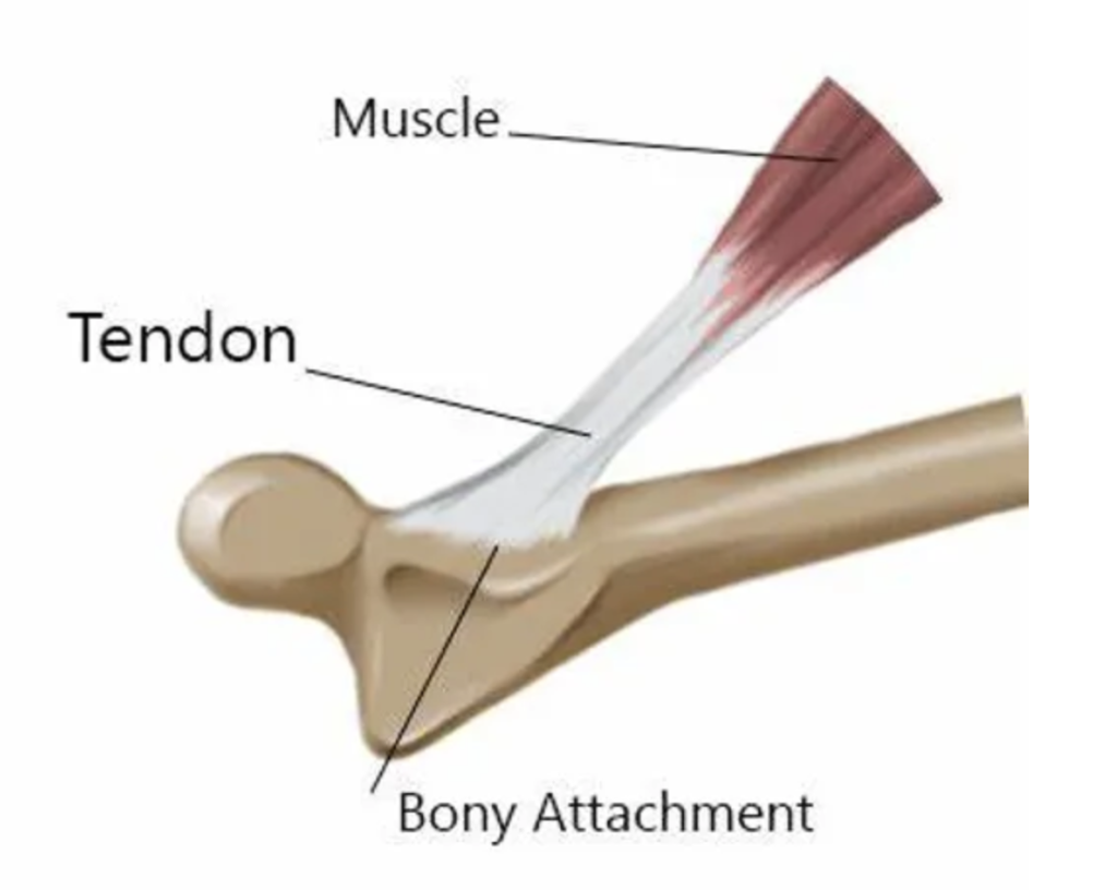 Understanding Tendinopathy: A Physiotherapist’s Guide to Recovery ...